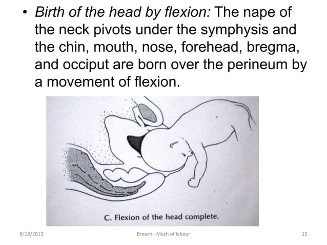 Breech mech of labour | PPTX | Pregnancy | Reproductive Health