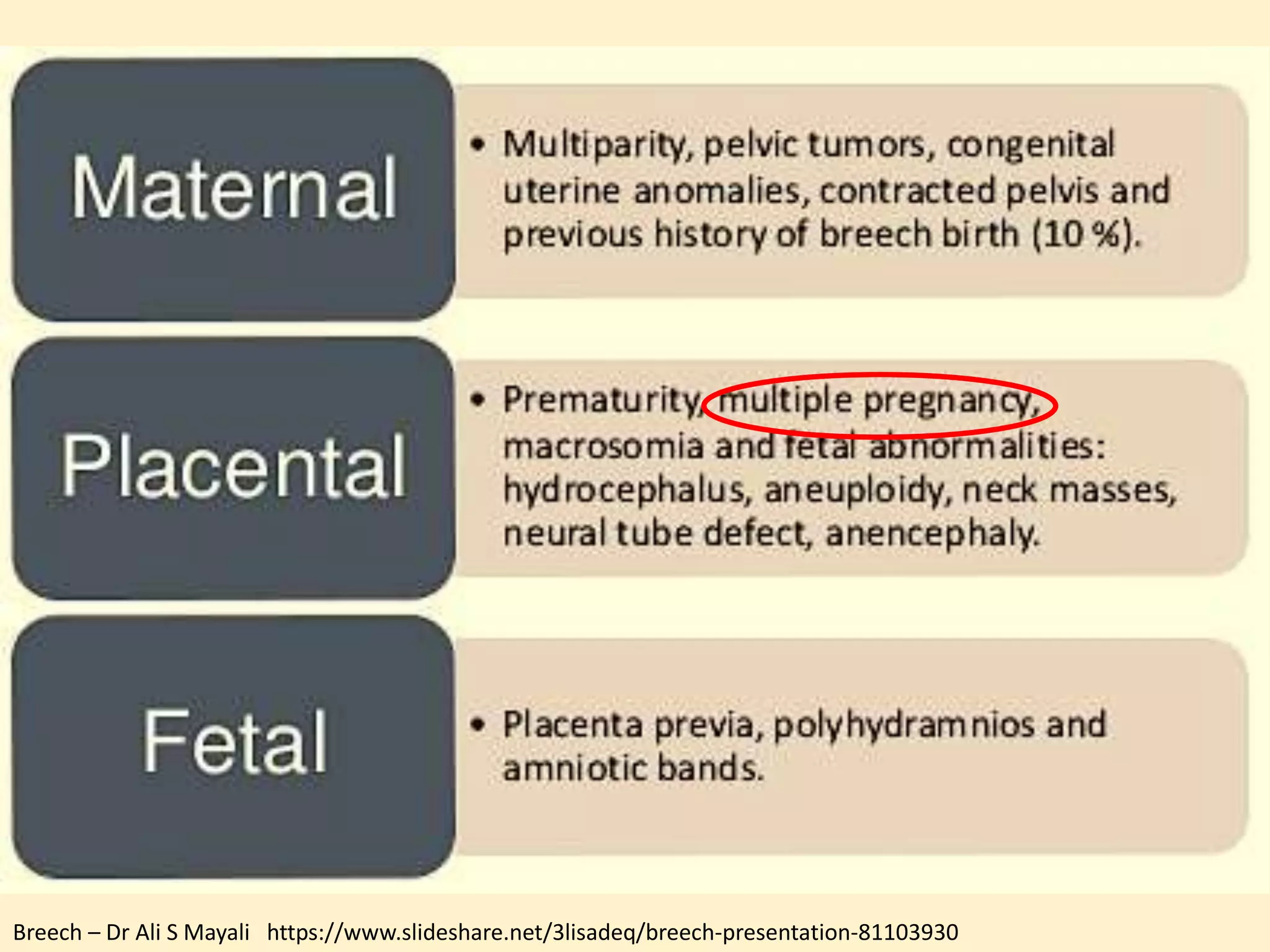 Breech Delivery | PPTX