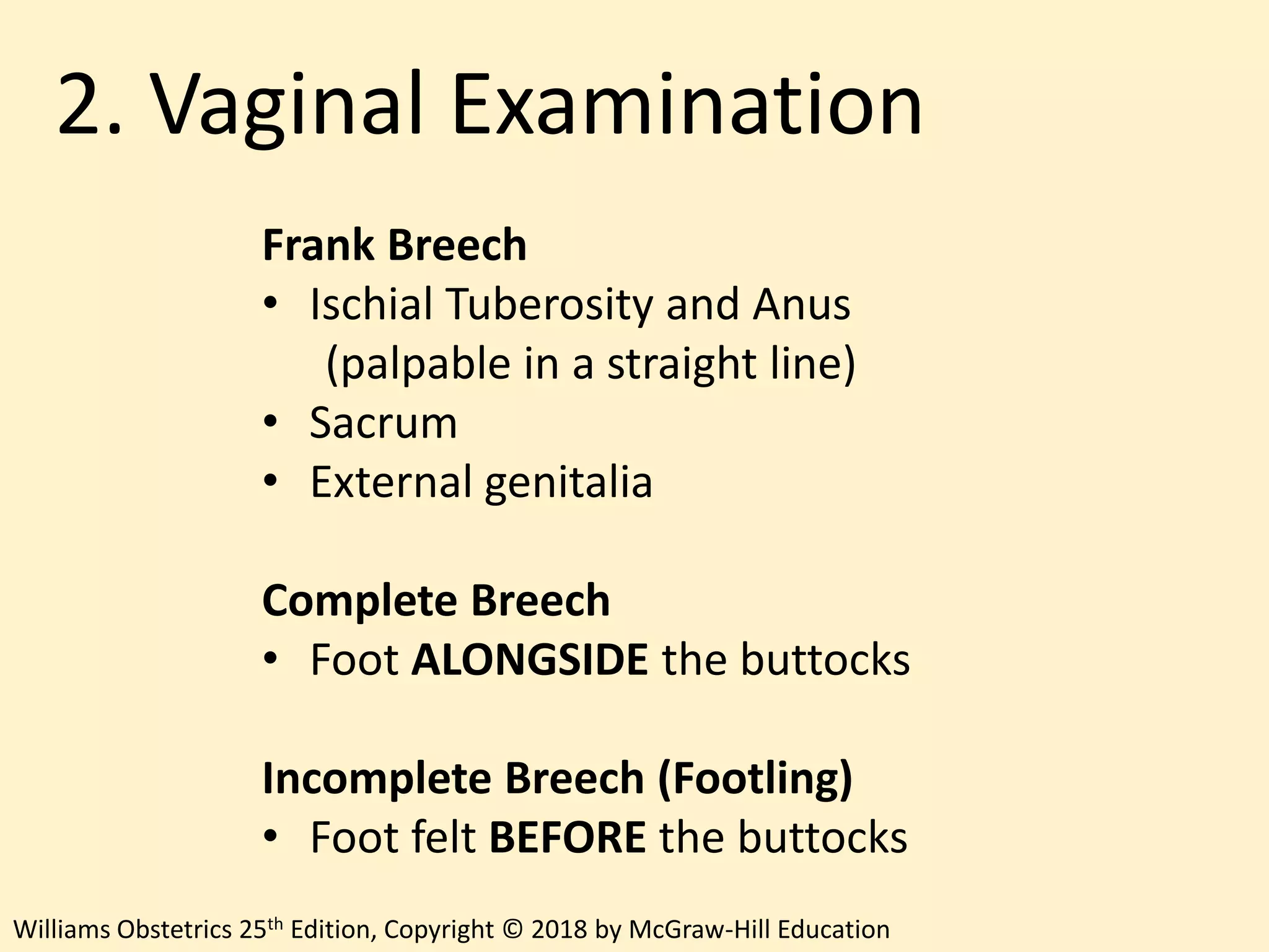 Breech Delivery | PPTX