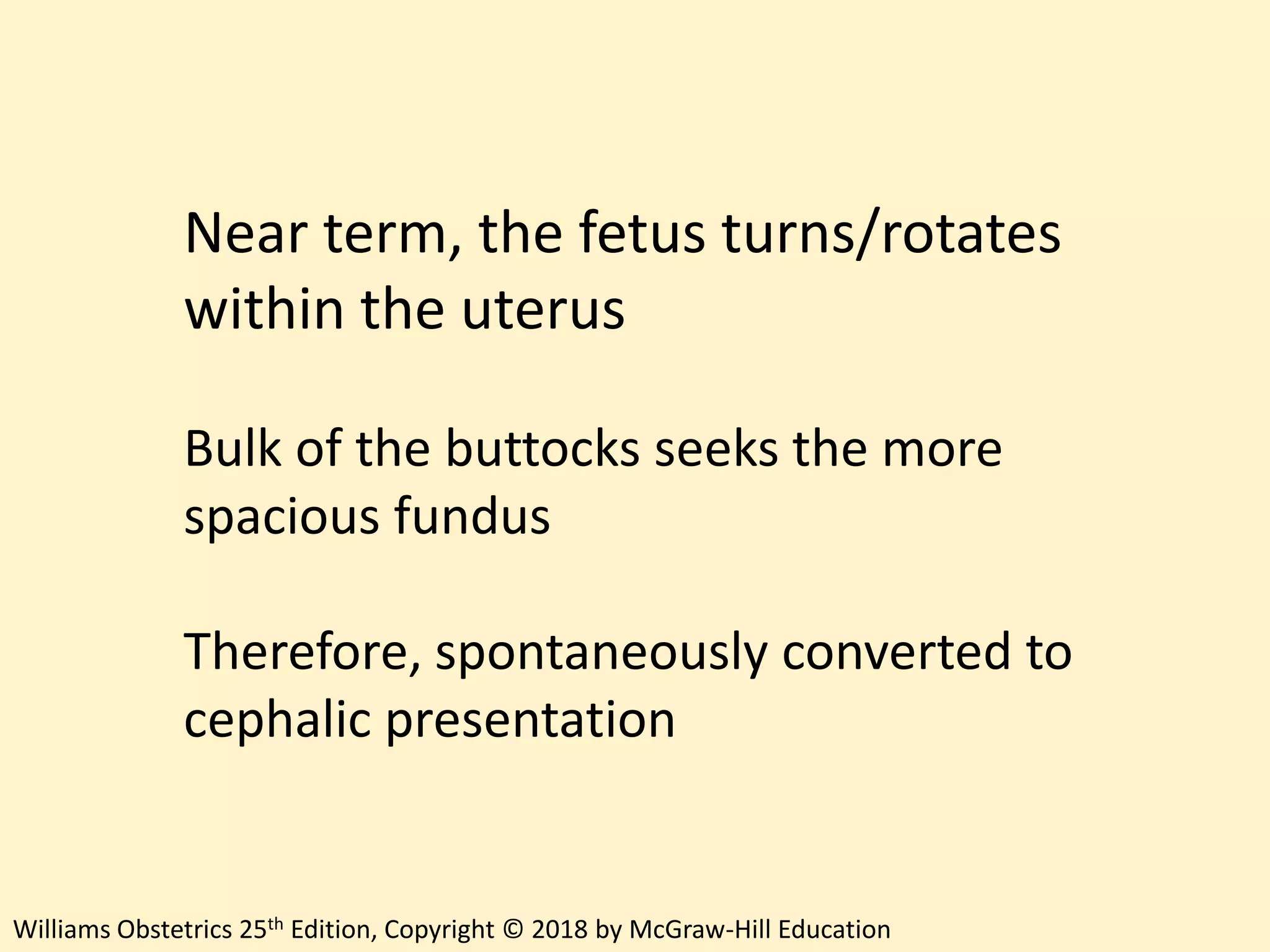 Breech Delivery | PPTX