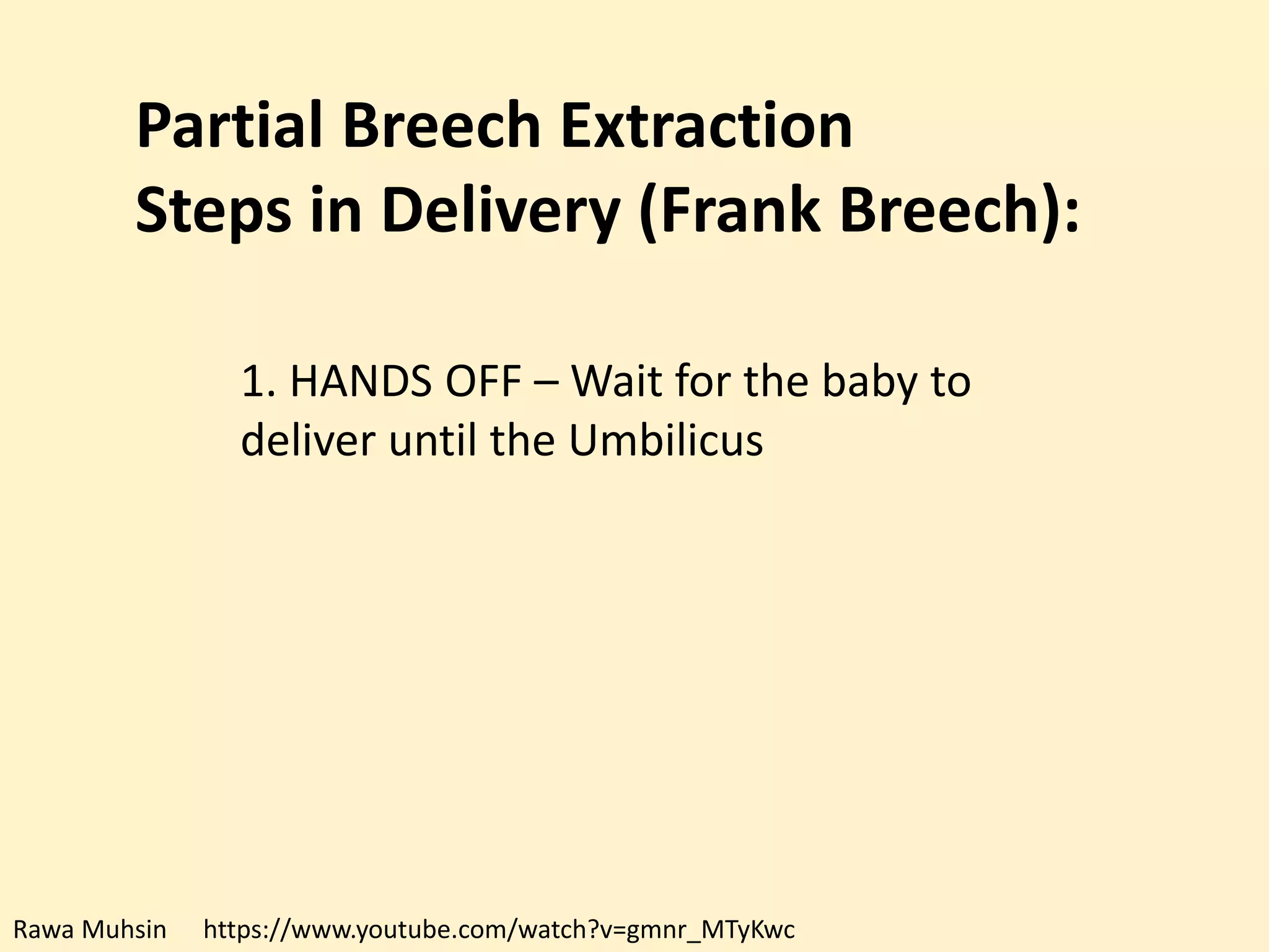 Breech Delivery | PPTX