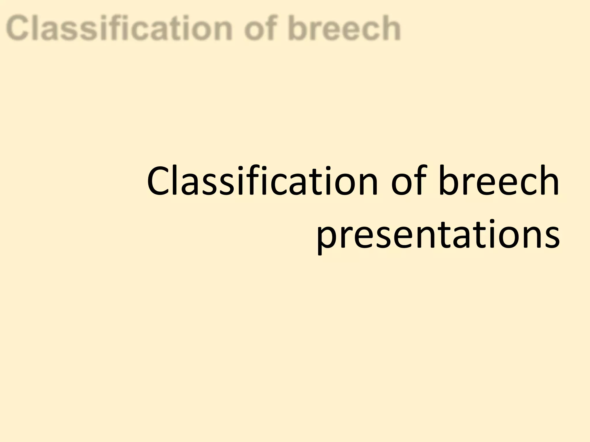 Breech Delivery | PPTX