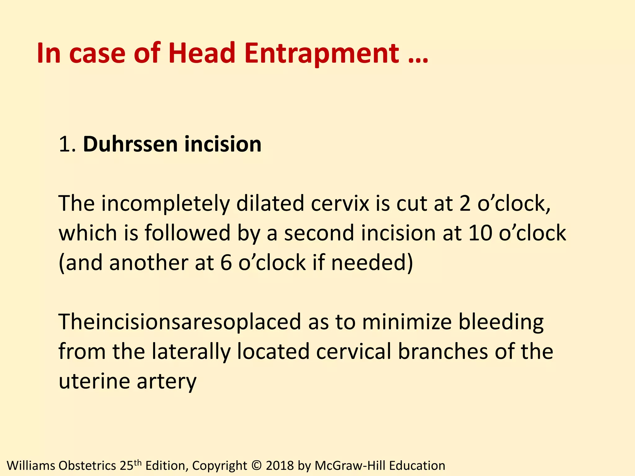Breech Delivery | PPTX