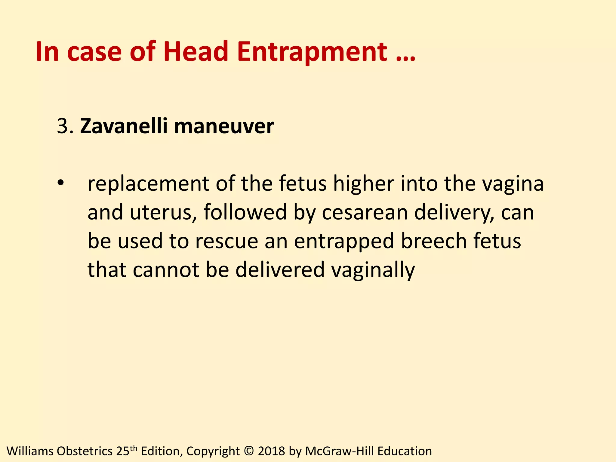 Breech Delivery | PPTX