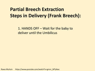Breech Delivery | PPTX