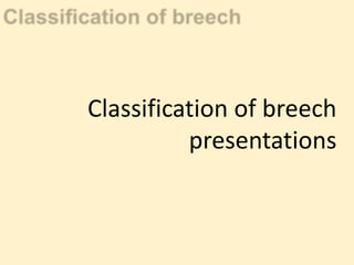 Breech Delivery | PPTX