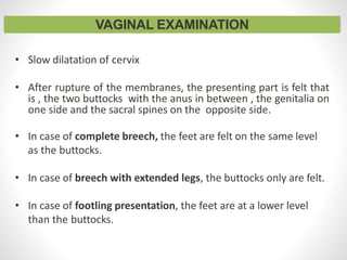 Breech presentation | PPTX