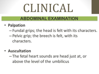 Breech presentation | PPTX