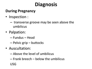 breech-presentation.ppt