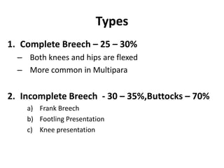 breech-presentation.ppt