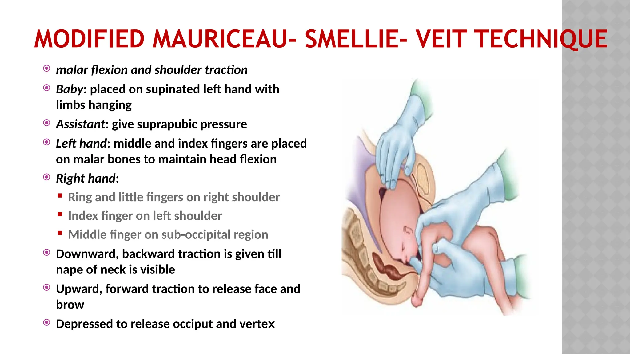 Breech presentation obstetrics .pptx