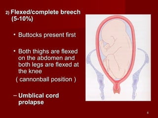 Breech | PPT