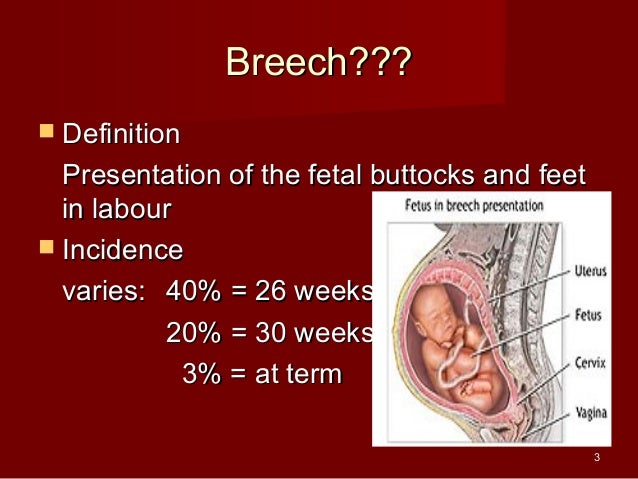 Breech