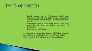 BREECH DELIVERY.pptx