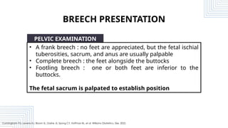 Breech Delivery Contraindication.ARB.pptx