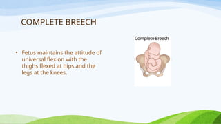 breech_mudaliar source obstretics and gynecology | PPTX