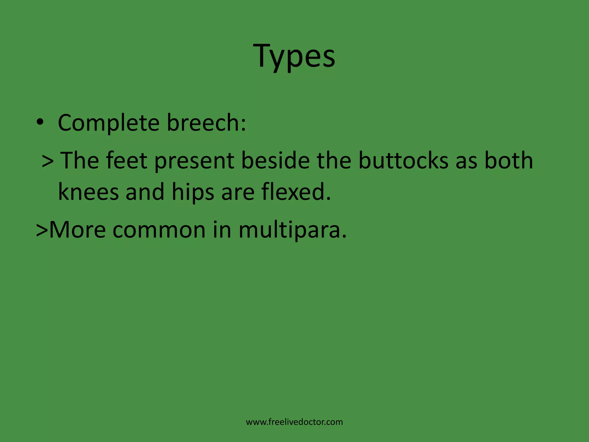 Breech presentation | PPTX