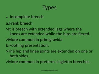Breech presentation | PPTX