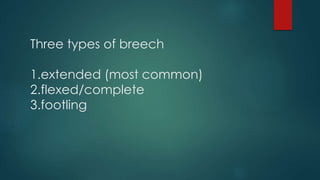 Breech presentation | PPTX