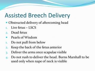 Breech Presentation | PDF