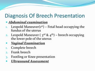 Breech Presentation | PDF