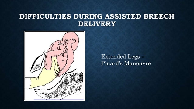 Breech presentation | PPTX | Pregnancy | Reproductive Health