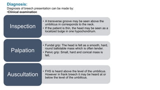 Breech presentation | PPTX