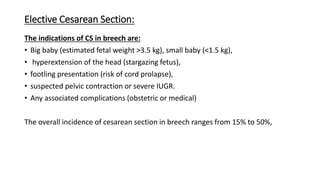 Breech presentation | PPTX | Pregnancy | Reproductive Health