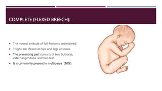 BREECH PRESENTATION.pptx