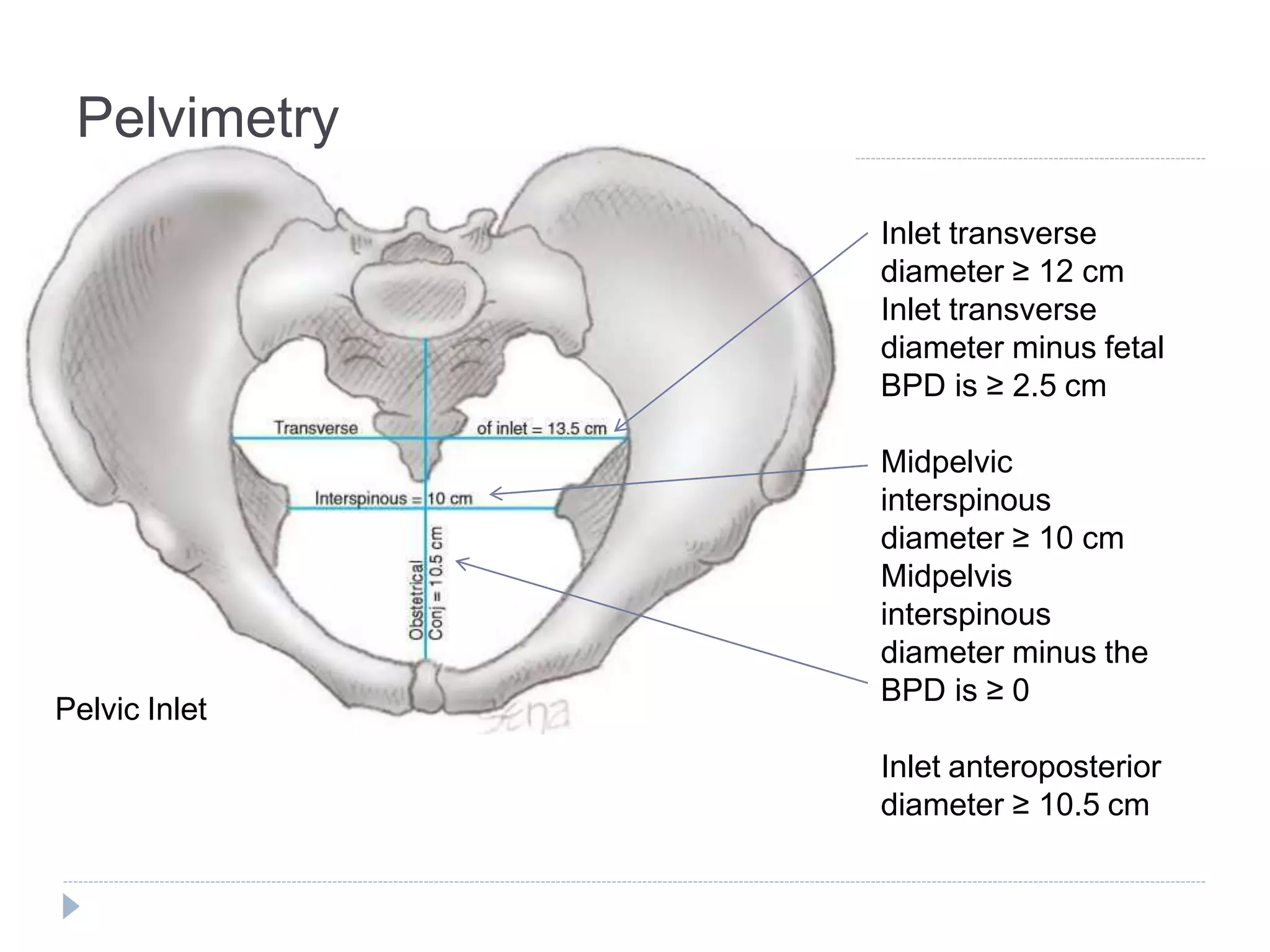 breech presentation.pptx