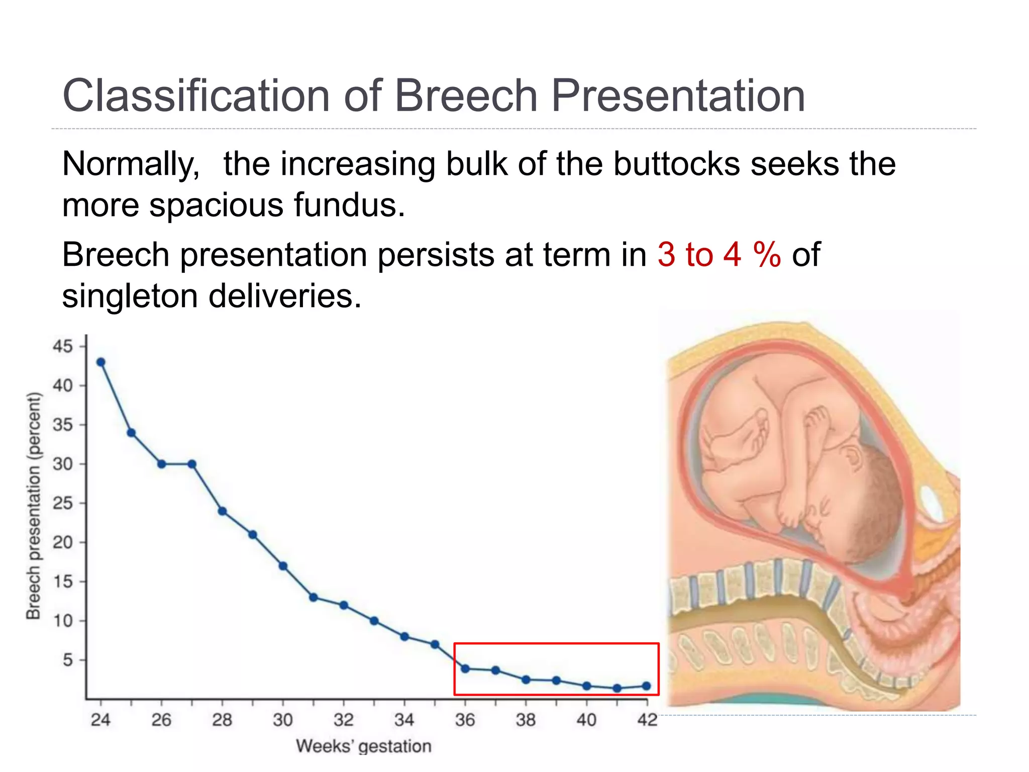 breech presentation.pptx