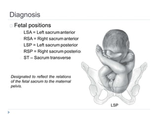breech presentation.pptx