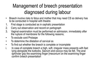 Breech presentation.pptx