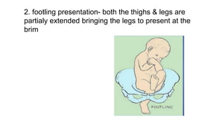 Breech presentation..pptx