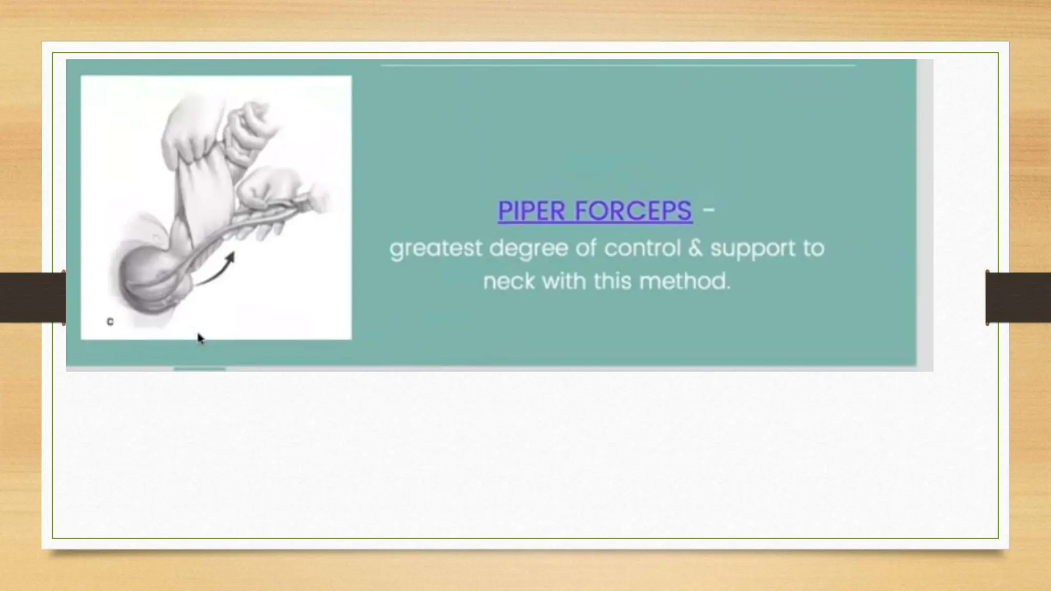 BREECH PRESENTATION, TYPES, DELIVERY.pptx