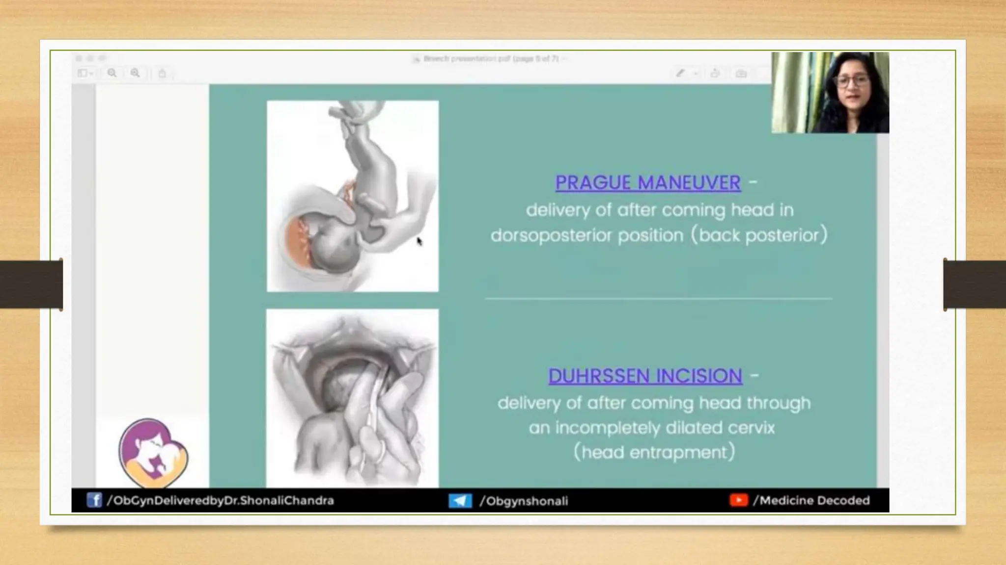 BREECH PRESENTATION, TYPES, DELIVERY.pptx