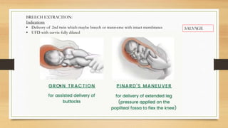 BREECH PRESENTATION, TYPES, DELIVERY.pptx | Pregnancy | Reproductive Health