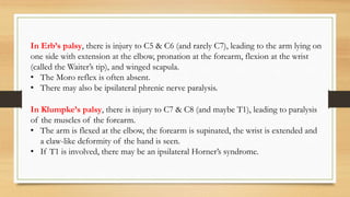 BREECH PRESENTATION, TYPES, DELIVERY.pptx