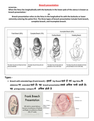 Breech presentation JITENDRA BHARGAV SLIDE SHARE .COM