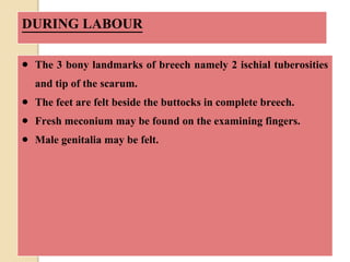 Breech presentation | PPTX