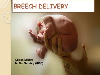 Breech Presentation Delivery