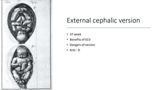 Breech presentation1 | PPTX