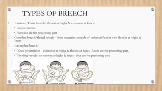 BREECH PRESENTATION obstetrics and gynacology mbbs final year | PPT