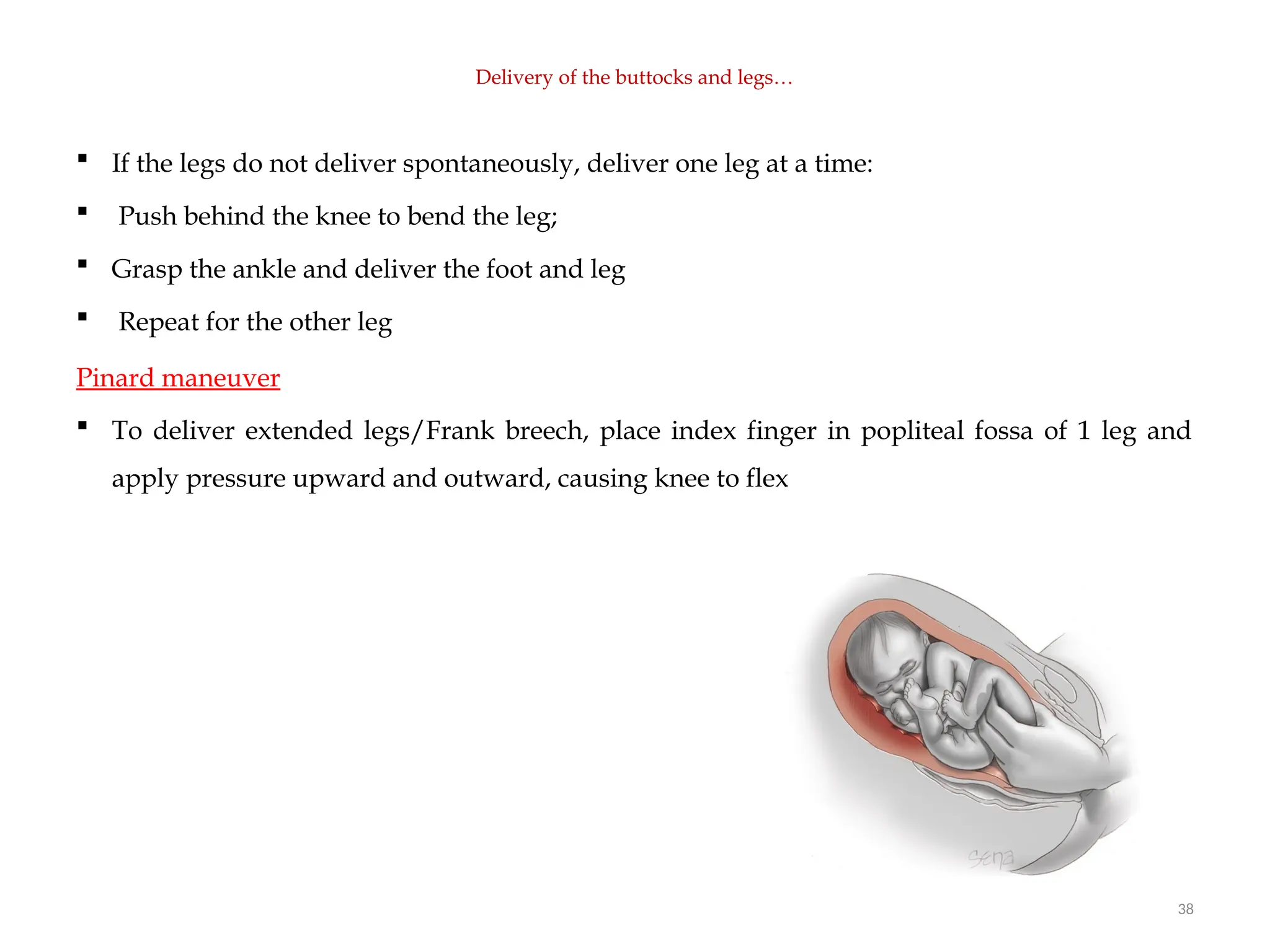 Breech Presentation 12.pptxggggbcxxxcccc | PPTX