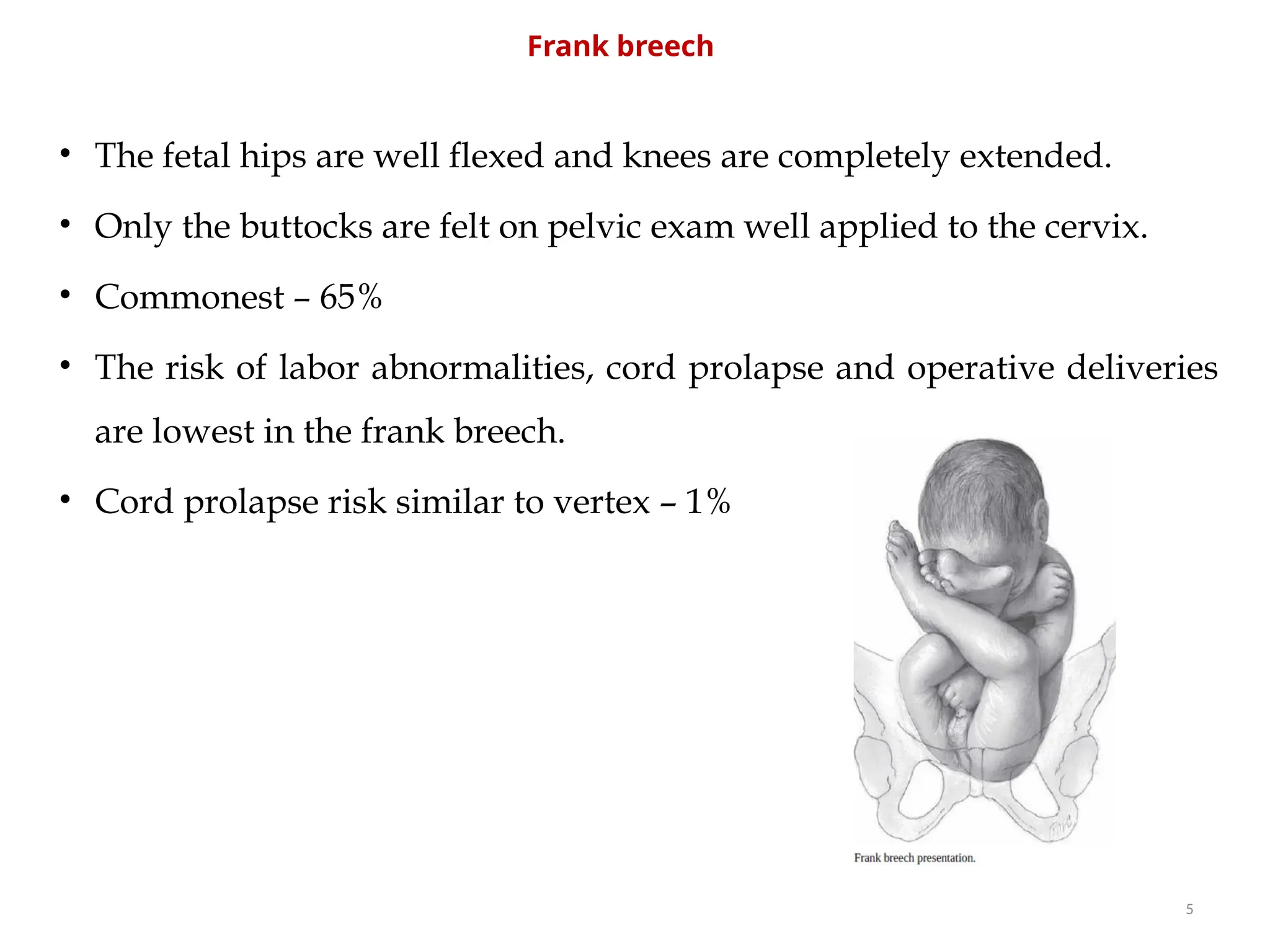 Breech Presentation 12.pptxggggbcxxxcccc | PPTX