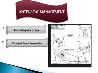 BREECH PRESENTATION abnormal condition.pptx