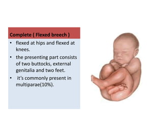 Breech presentation and delivery | PPTX