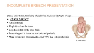 BREECH PRESENTATION Anju.pptx