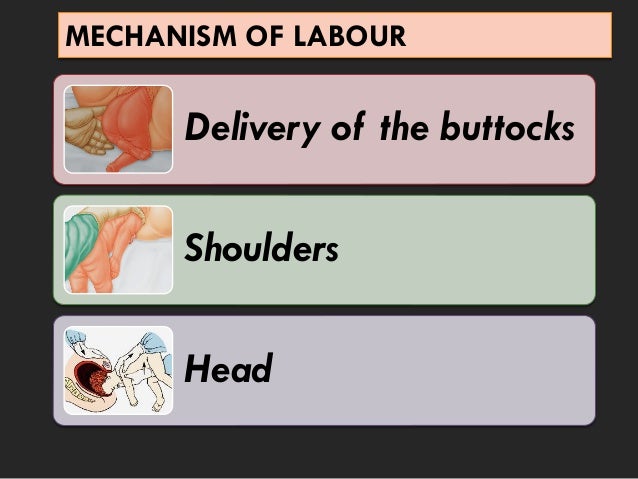 Breech presentation for 4th year med.students