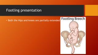 Breech presentation new 1.pdf